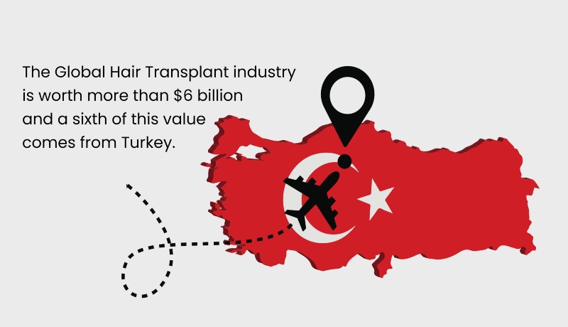 Hair Transplant in Turkey | All-Inclusive Packages